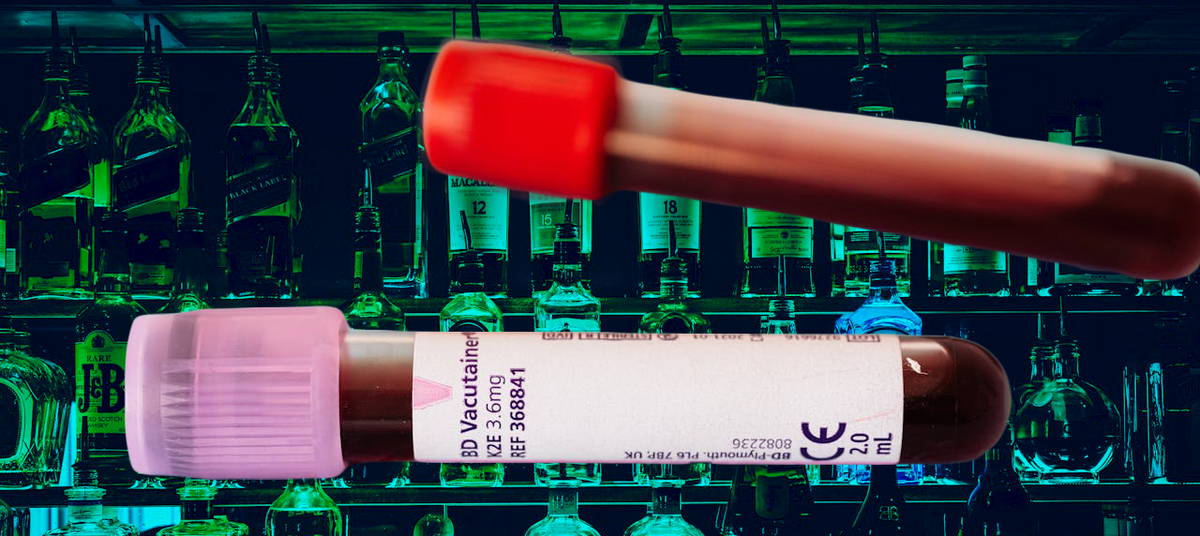 Guide to Different Alcohol Tests and When to Use Them – Drug Test London